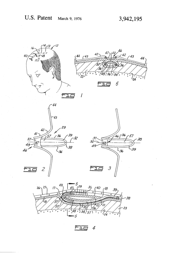 TODAY’S PATENT – HAIRPIECE ANCHOR - Patent Blog