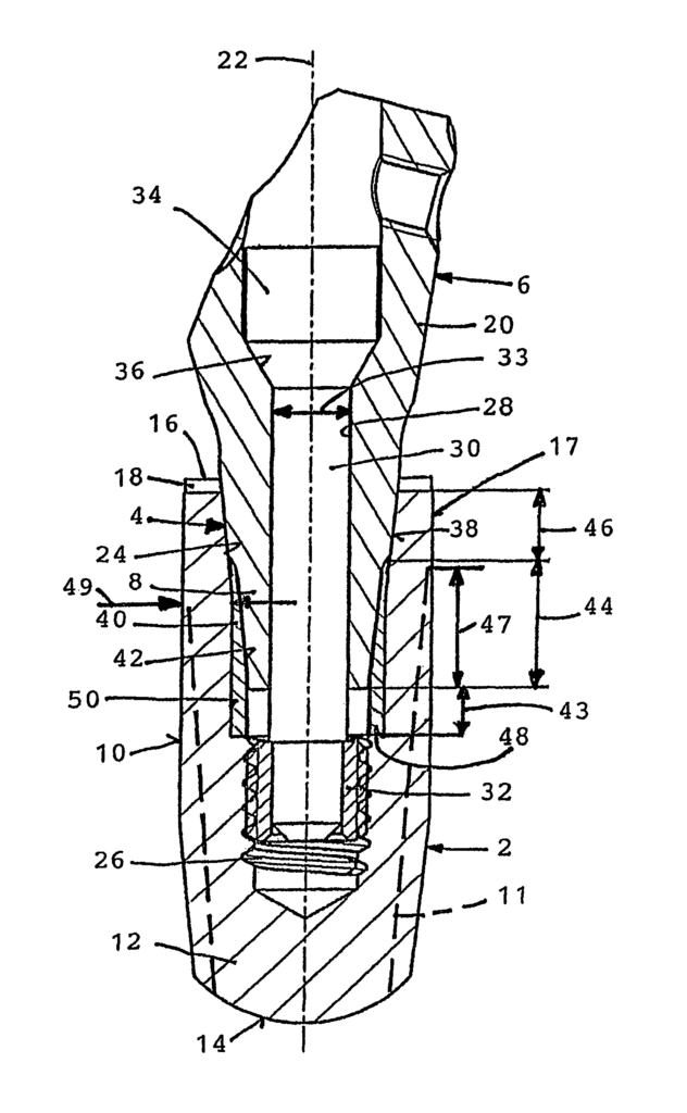 TODAY'S PATENT - THE DENTAL IMPLANT - Patent Blog